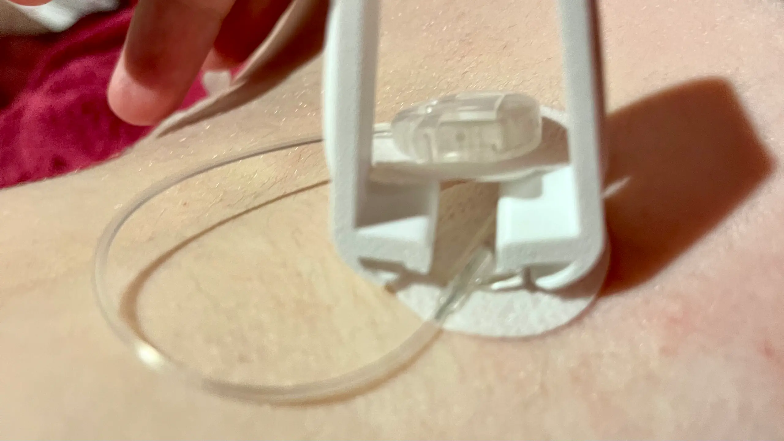 3D Printer Files | 3MF File | Sure-T Steel Cannula insertion tool ...