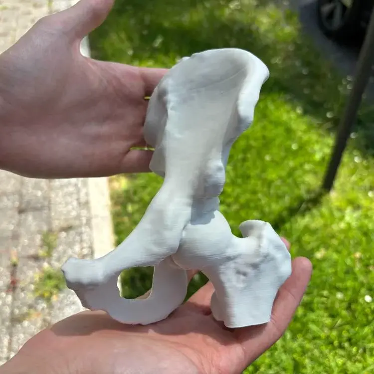 3D Printer Files | 3MF File | Human Hip (From REAL CT scan) | Creality ...